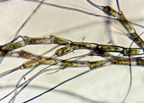 Bulbochaete (Oedogoniaceae) » Manaaki Whenua