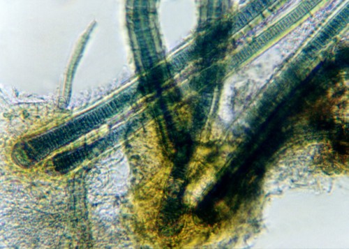 Calothrix (Rivulariaceae) » Manaaki Whenua