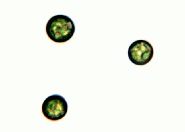 Chlorella - like unicells (Chlorellaceae) » Manaaki Whenua