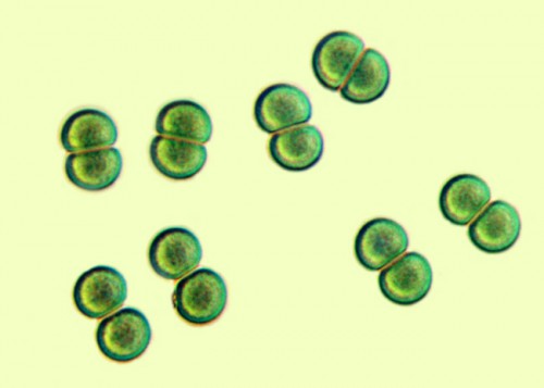 Chroococcus (Chroococcaceae) » Manaaki Whenua