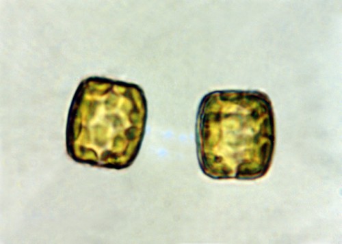 Cyclotella cf stelligera (Stephanodiscaceae) » Manaaki Whenua