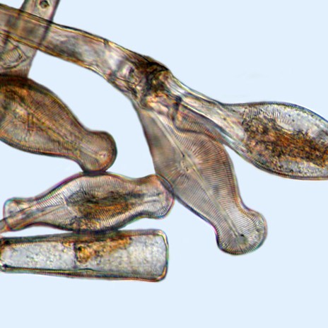 Diatom structure » Manaaki Whenua