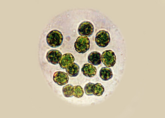 Eudorina Under Microscope