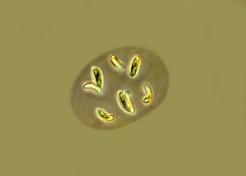 Kirchneriella (Oocystaceae) » Manaaki Whenua