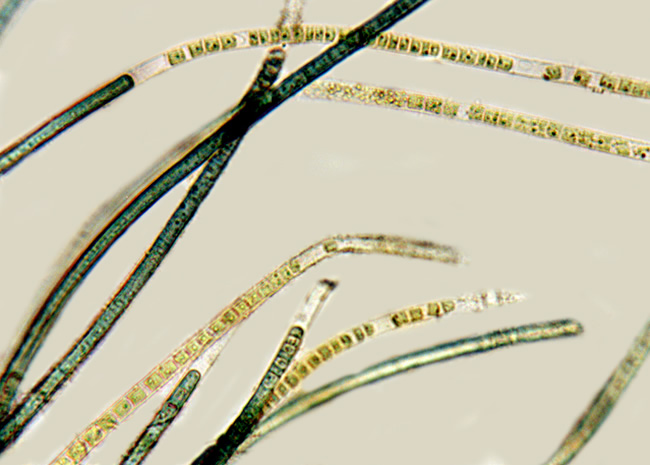 Lyngbya Under Microscope