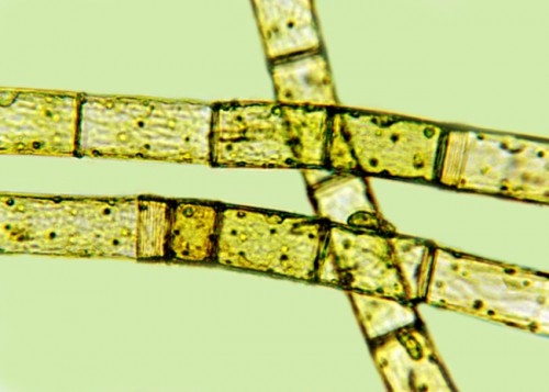 Oedogonium (Oedogoniaceae) » Manaaki Whenua