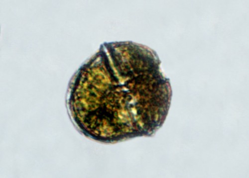 Peridinium (Peridiniidae) » Manaaki Whenua