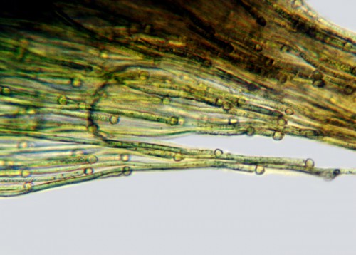 Rivularia (Rivulariaceae) » Manaaki Whenua